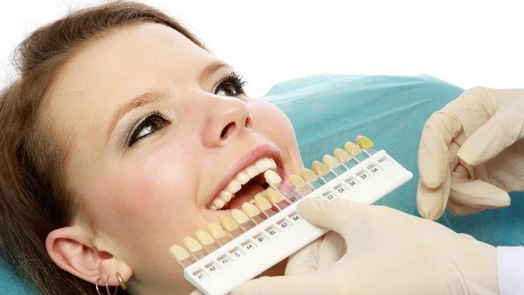 What to Expect at Your Teeth Whitening Session | Poway CA